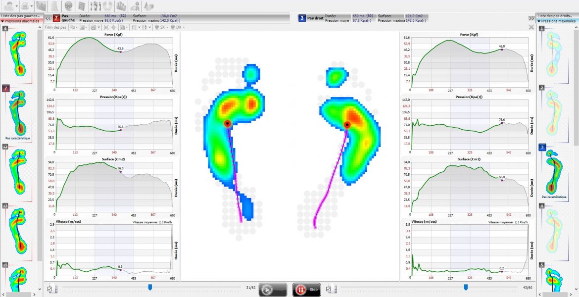Podologie pédiatrique – VL Orthopédie